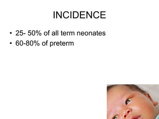 unit 3 nursing care of a neonate Hyperbilirubinemia neonate.ppt