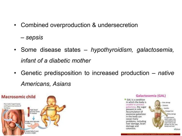 unit 3 nursing care of a neonate Hyperbilirubinemia neonate.ppt | Pregnancy | Reproductive Health