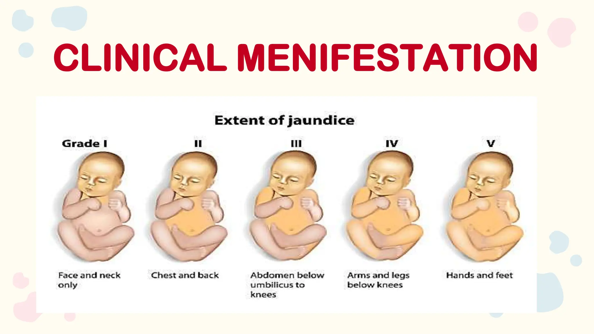 Neonatal hyperbilirubinemia pediatric nursing | PPTX