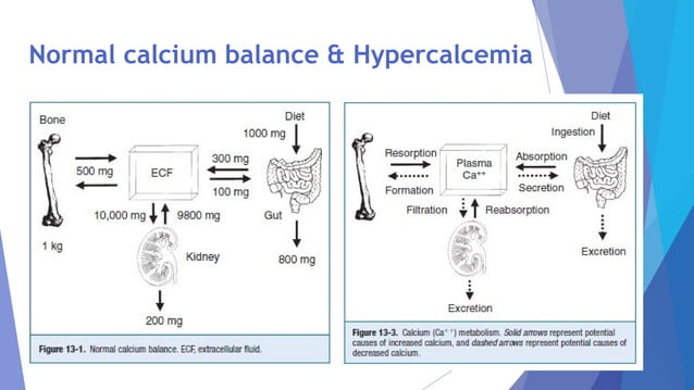 Hypercalcemia | PPT | Endocrine and Metabolic Diseases | Diseases and Conditions