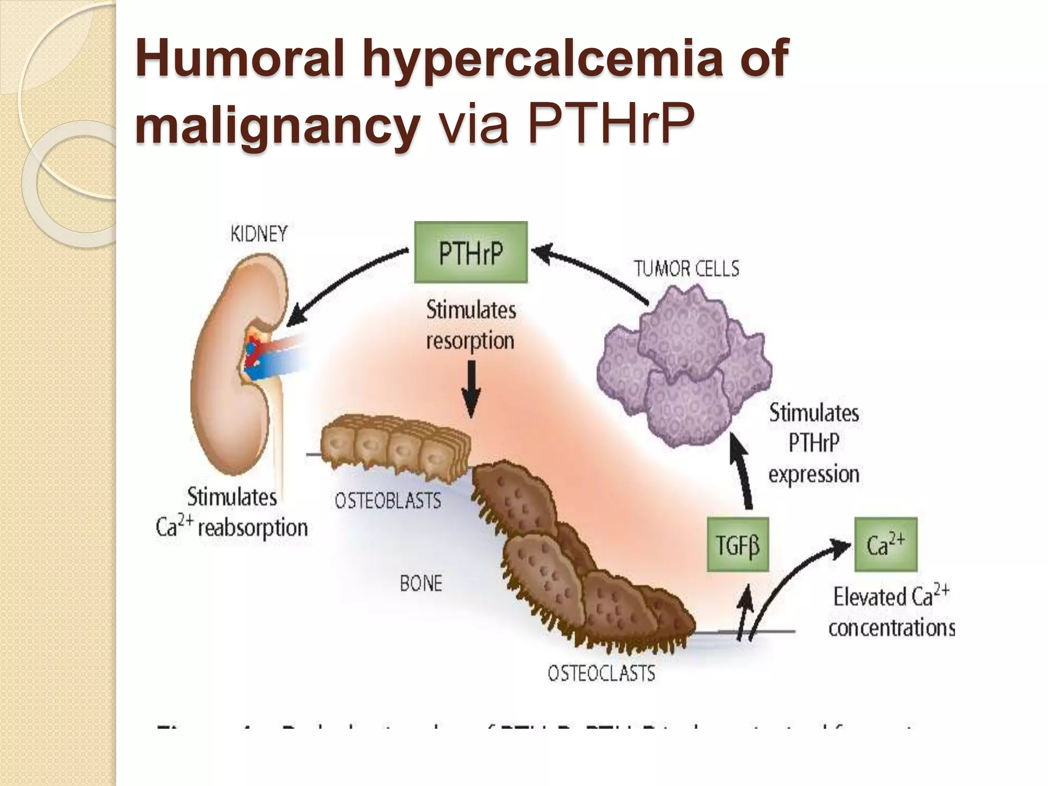 HYPERCALCEMIA ASSOCIATED WITH MALIGNANCY.pptm (2).pptx