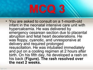 Hypercalcemia in children and adolescent | PPT