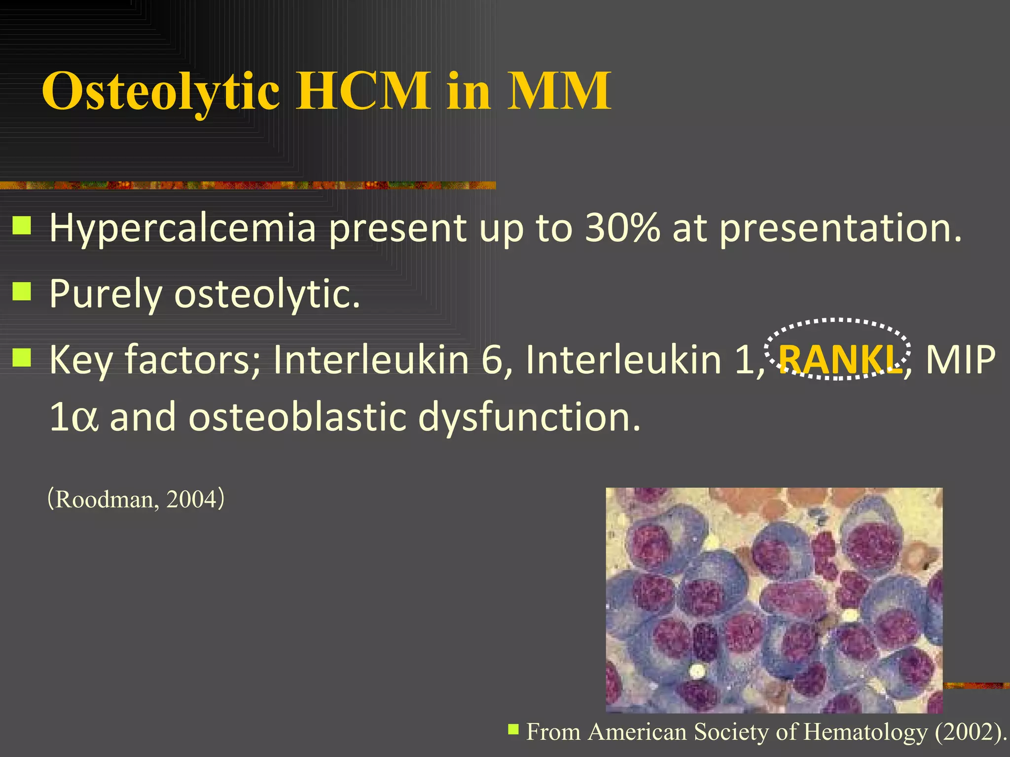 Hypercalcemia of malignancy | PPT