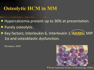 Hypercalcemia of malignancy | PPT