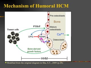 Hypercalcemia of malignancy | PPT
