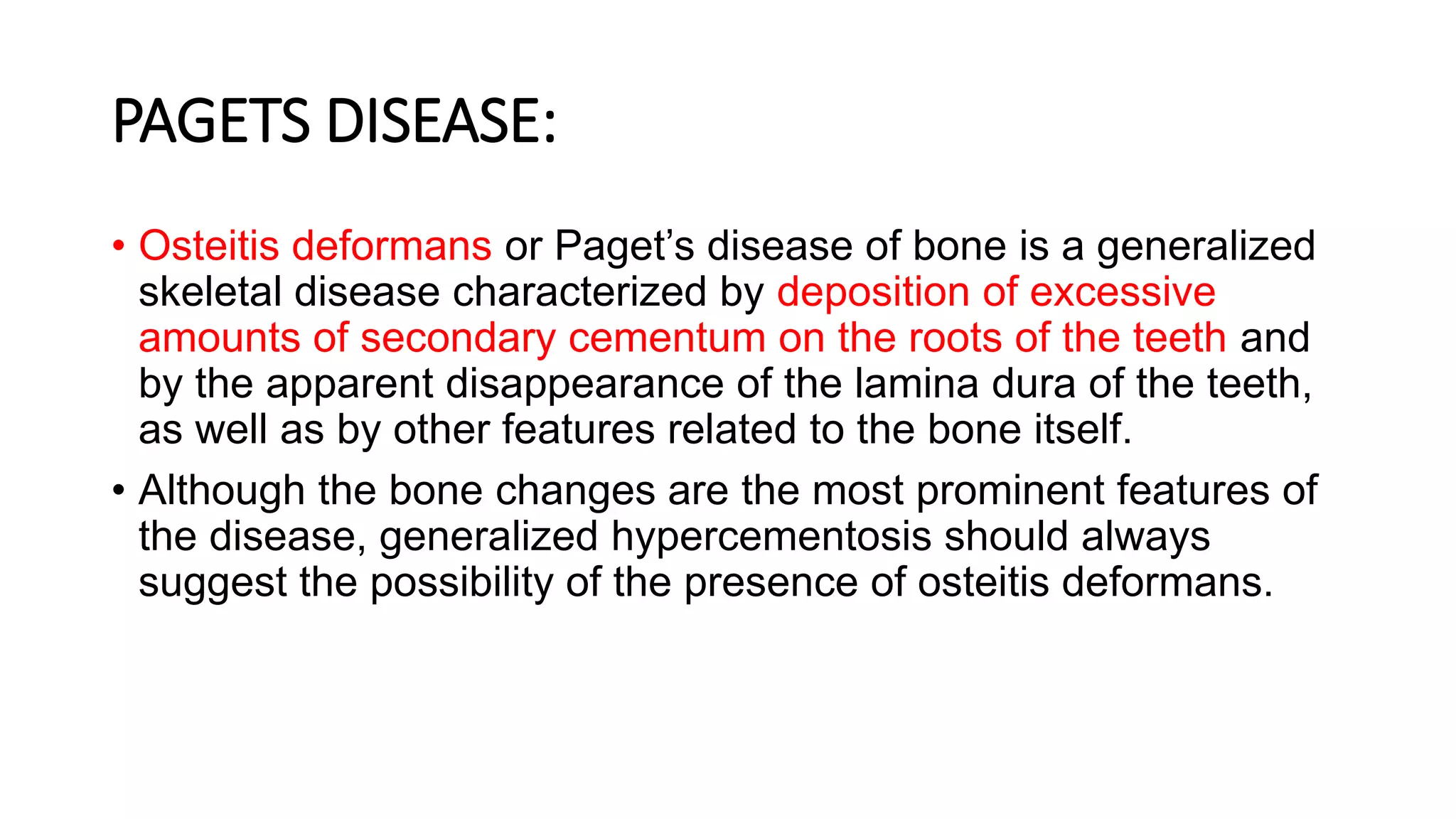 Hypercementosis | PPTX