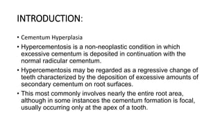 Hypercementosis | PPTX