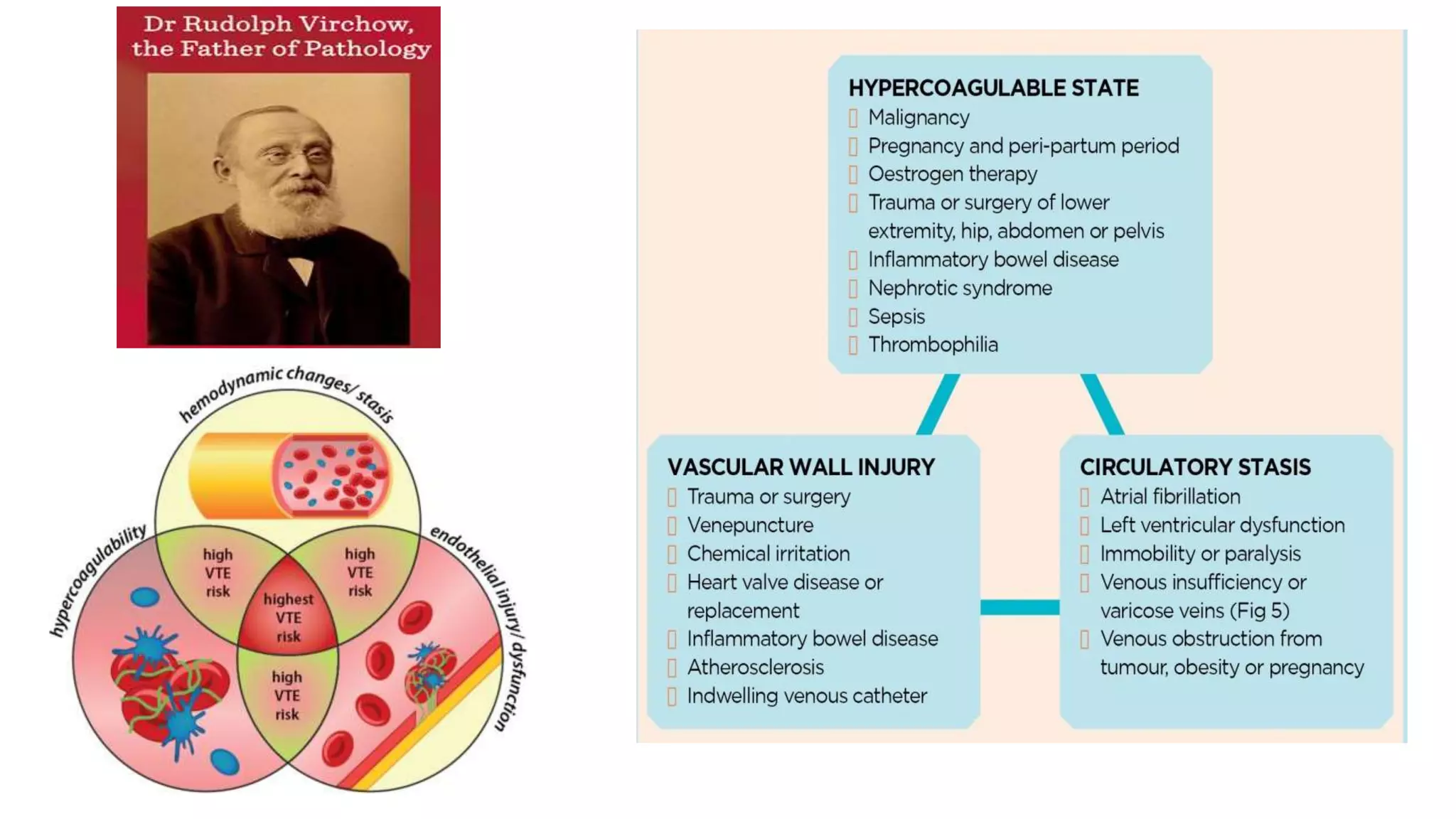 Hypercoagulable state.pptx