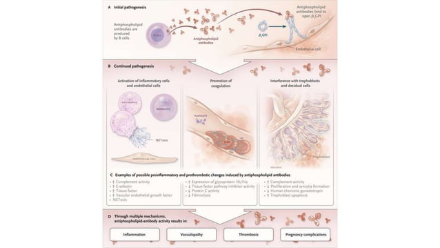 Hypercoagulable states | PPTX