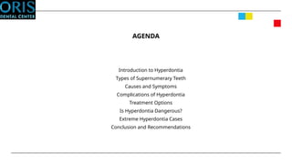 Hyperdontia (Extra Teeth) - Oris Dental .pptx
