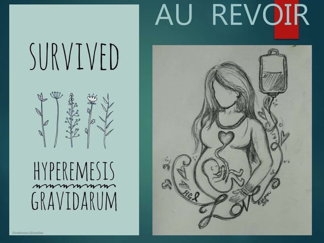 HYPEREMESIS GRAVIDARUM | PPT