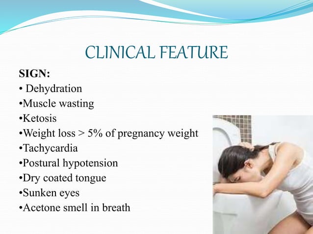 Hyperemesis Gravidarum.pptx