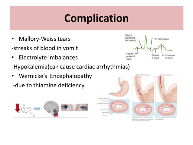 HYPEREMESIS GRAVIDARUM (intractable nausea and vomiting during ...