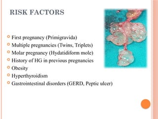 Hyperemesis Gravidarum (Pregnancy issue) | PPT