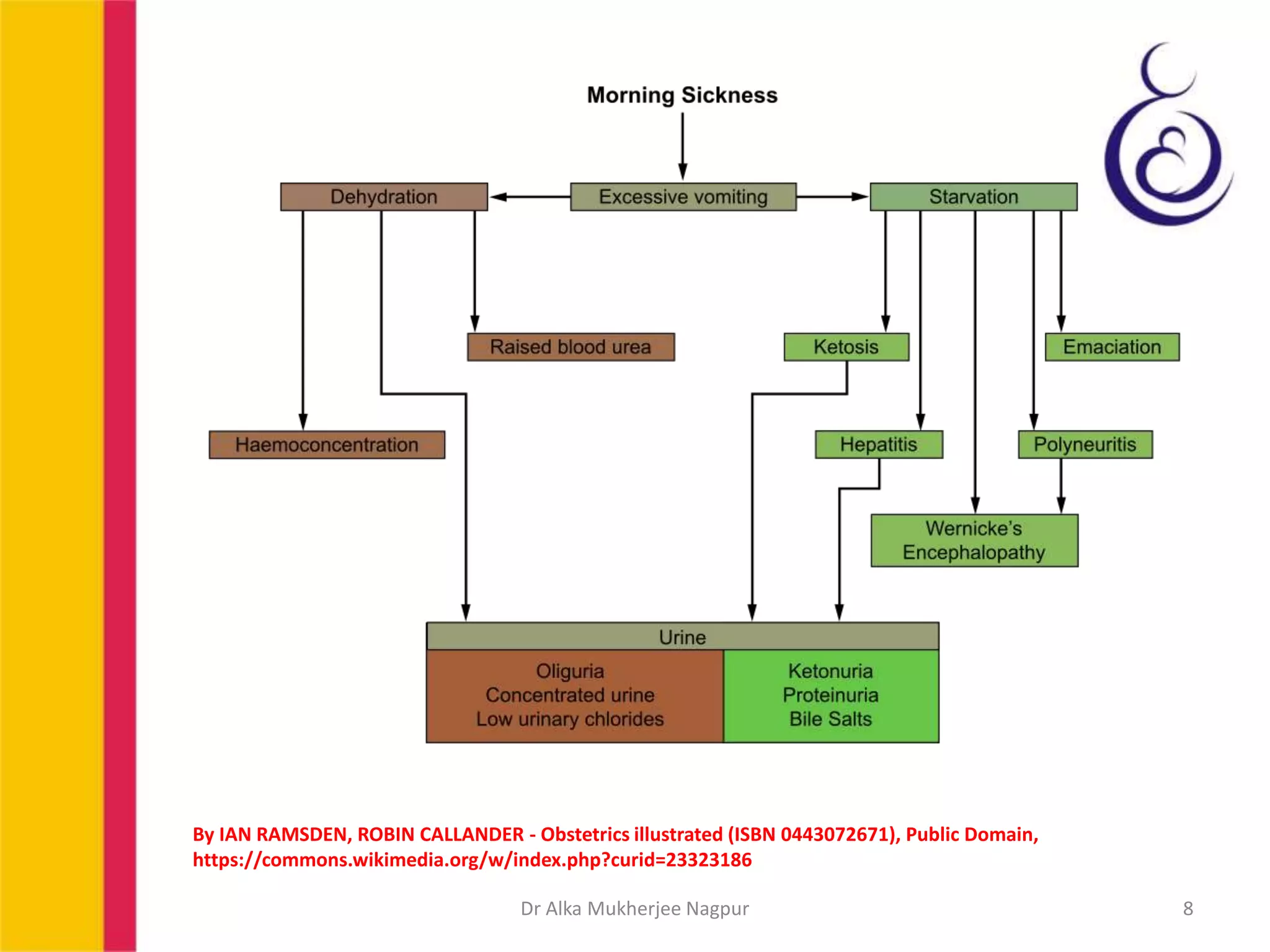 Hyperemesis Gravidarum by Dr Alka Mukherjee Dr Apurva Mukherjee | PPTX