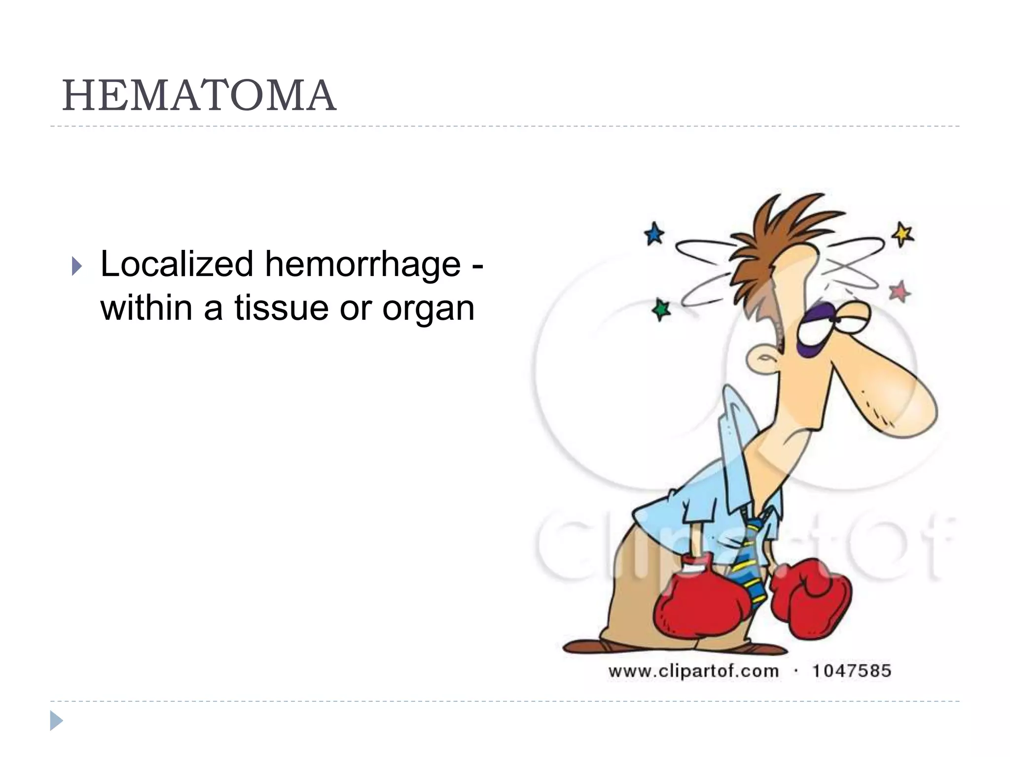 Hemodynamics - Hyperemia | PPTX