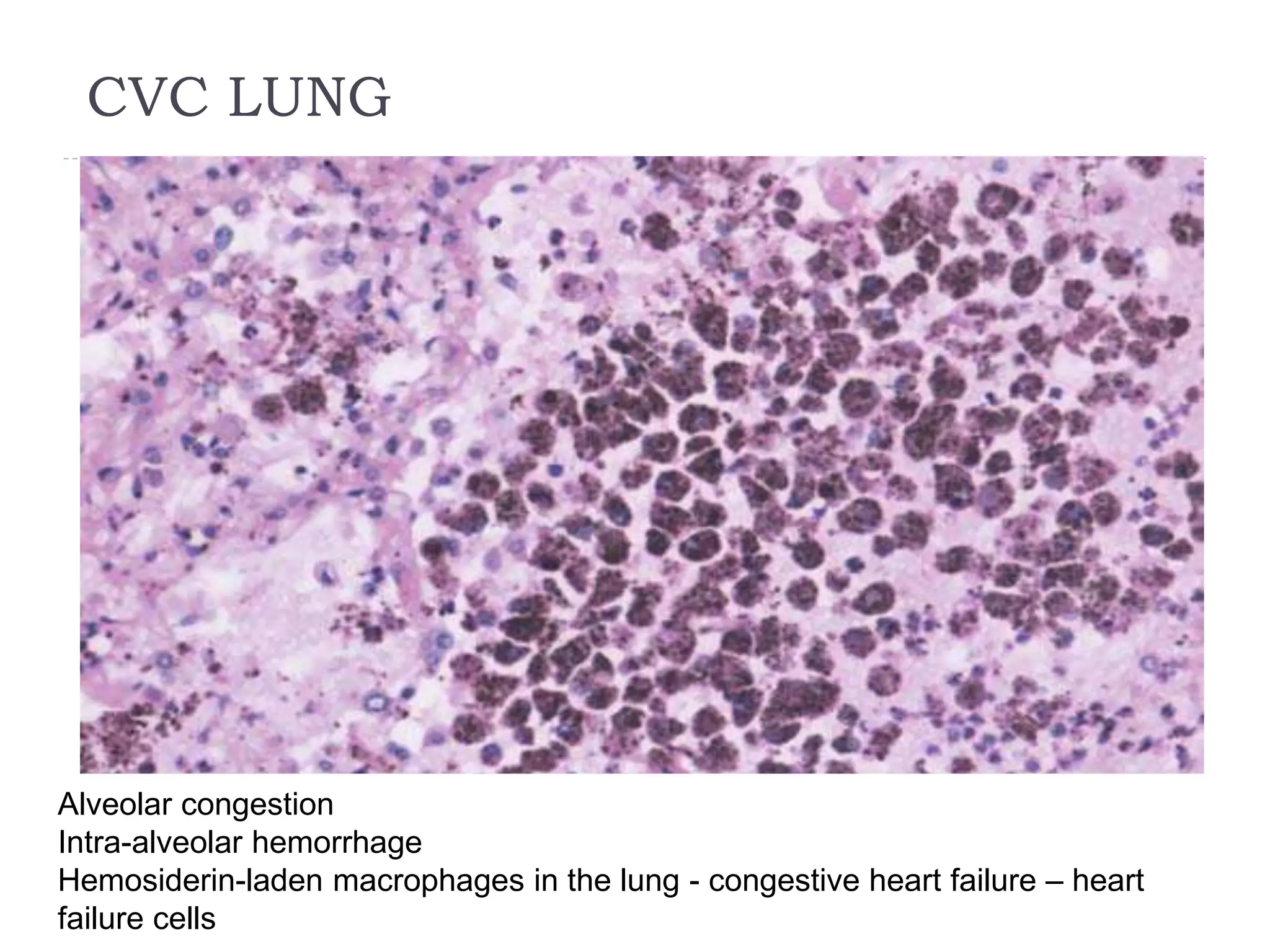 Hemodynamics - Hyperemia | PPTX