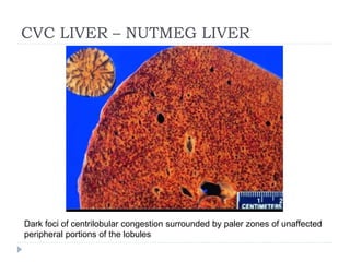 Hemodynamics - Hyperemia | PPTX
