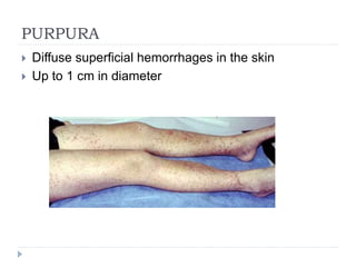 Hemodynamics - Hyperemia | PPTX