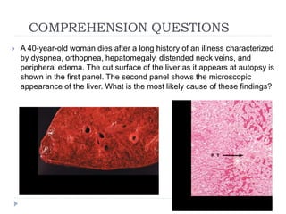Hemodynamics - Hyperemia | PPTX