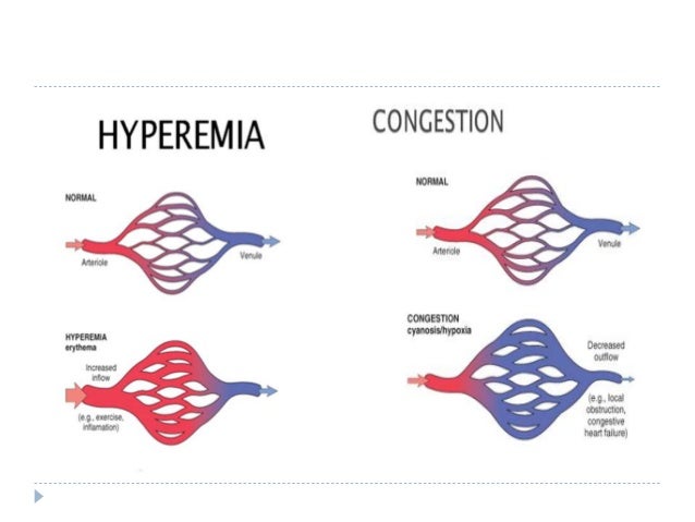 Hemodynamics - Hyperemia