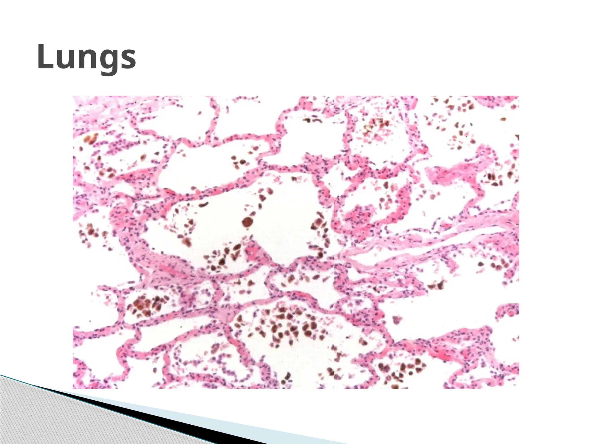 Hyperemia and Congestion.pptx ............ | PPTX