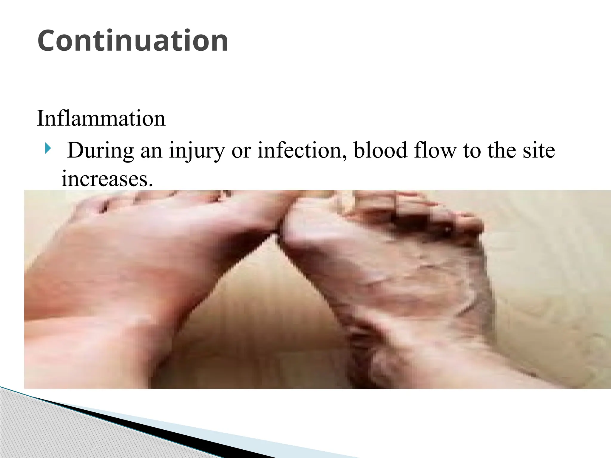 Hyperemia and Congestion.pptx ............ | PPTX