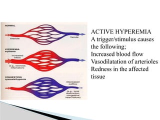 Hyperemia and Congestion.pptx ............ | PPTX
