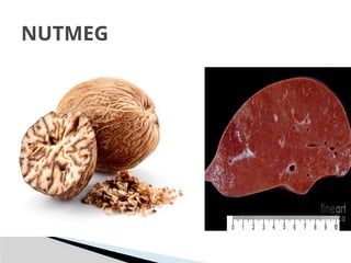 Hyperemia and Congestion.pptx ............ | PPTX
