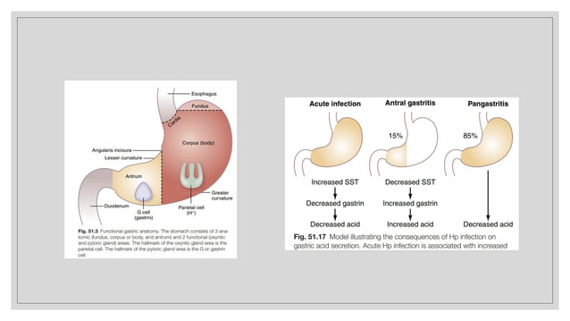 HYPERGASTRINEMIA AND ZOLLINGER ELLISON SYNDROME.pptx
