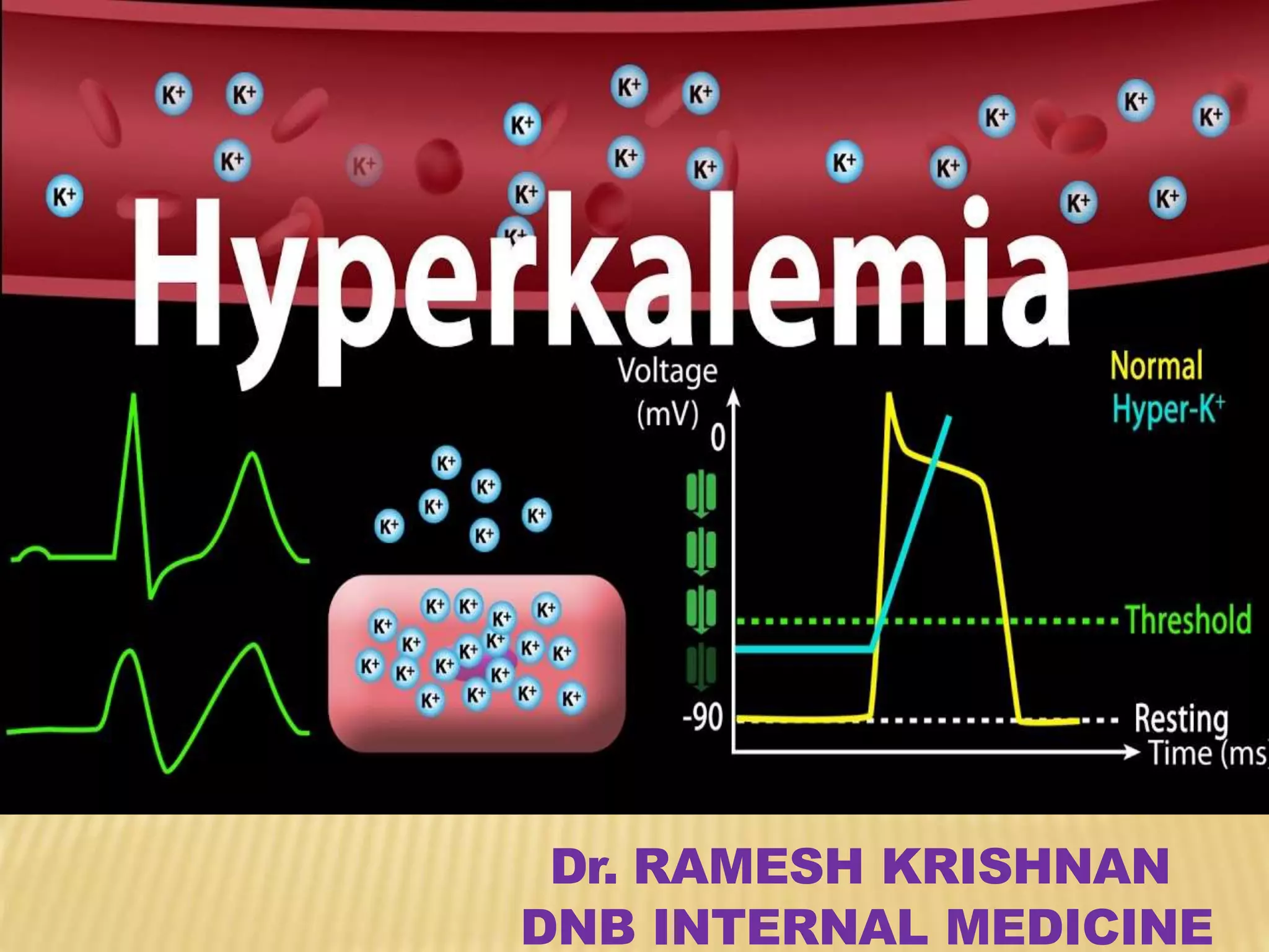 Diagnosis and management of Hyperkalemia | PPTX