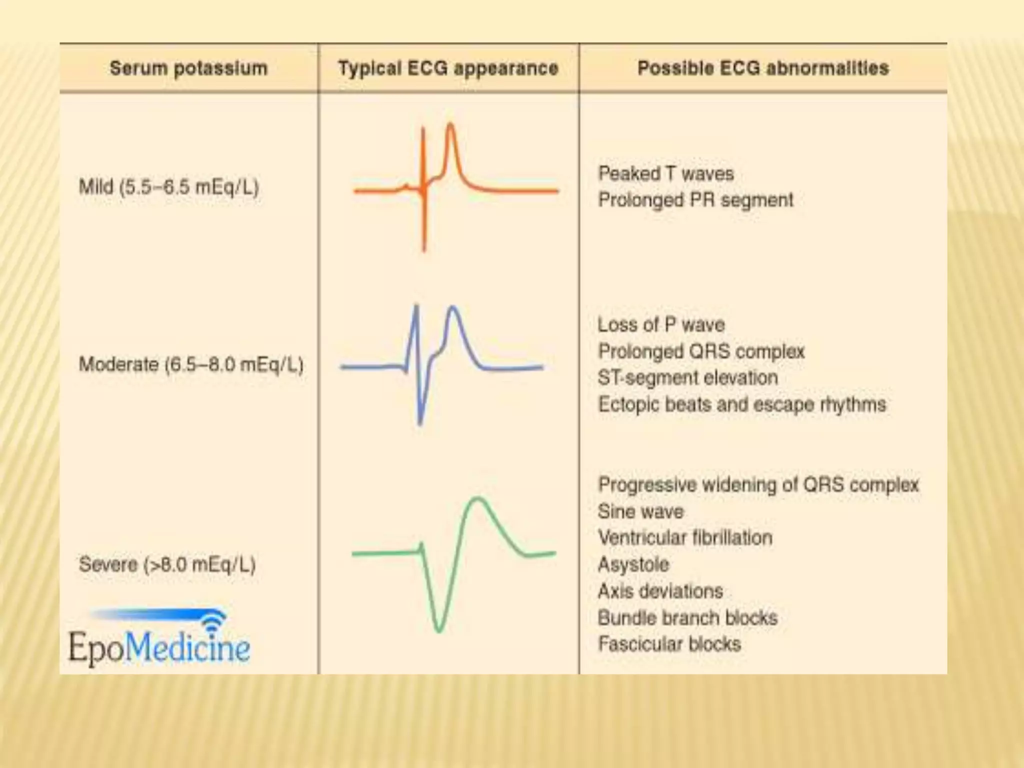 Diagnosis and management of Hyperkalemia | PPTX