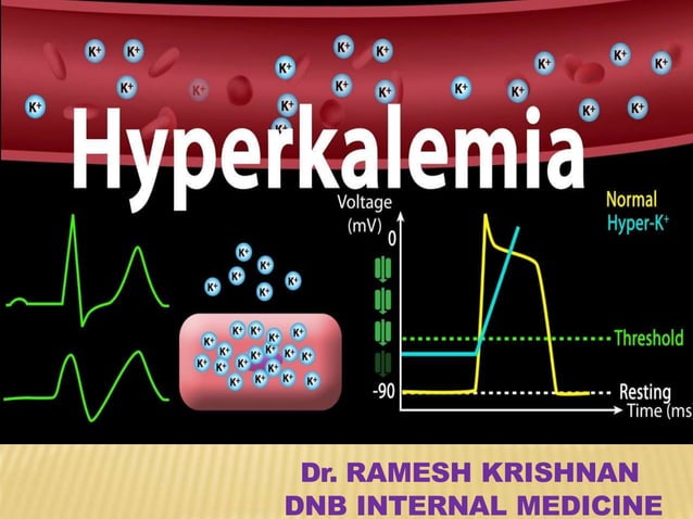 Diagnosis and management of Hyperkalemia | PPTX