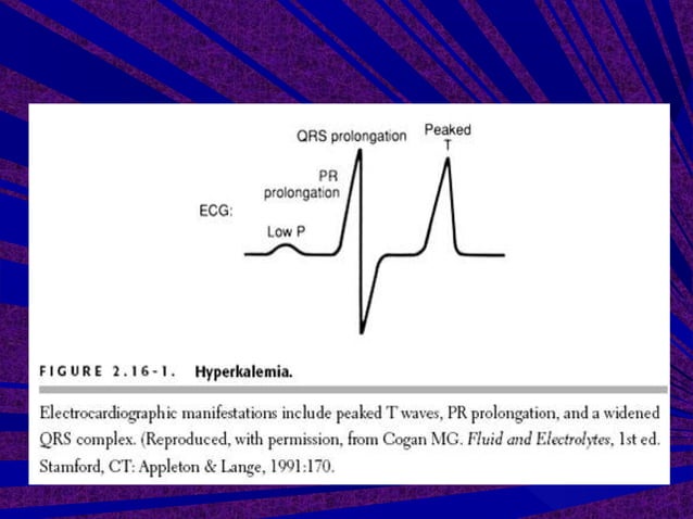Hyperkalemia in children | PPT