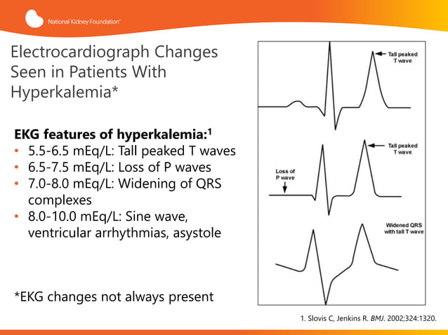 Hyperkalemia | PPTX | Heart and Cardiovascular Diseases | Diseases and ...