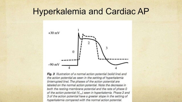 Hyperkalemia pathophysiology and treatment | PPTX