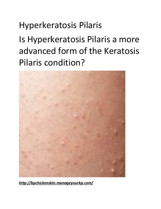 Hyperkeratosis Face