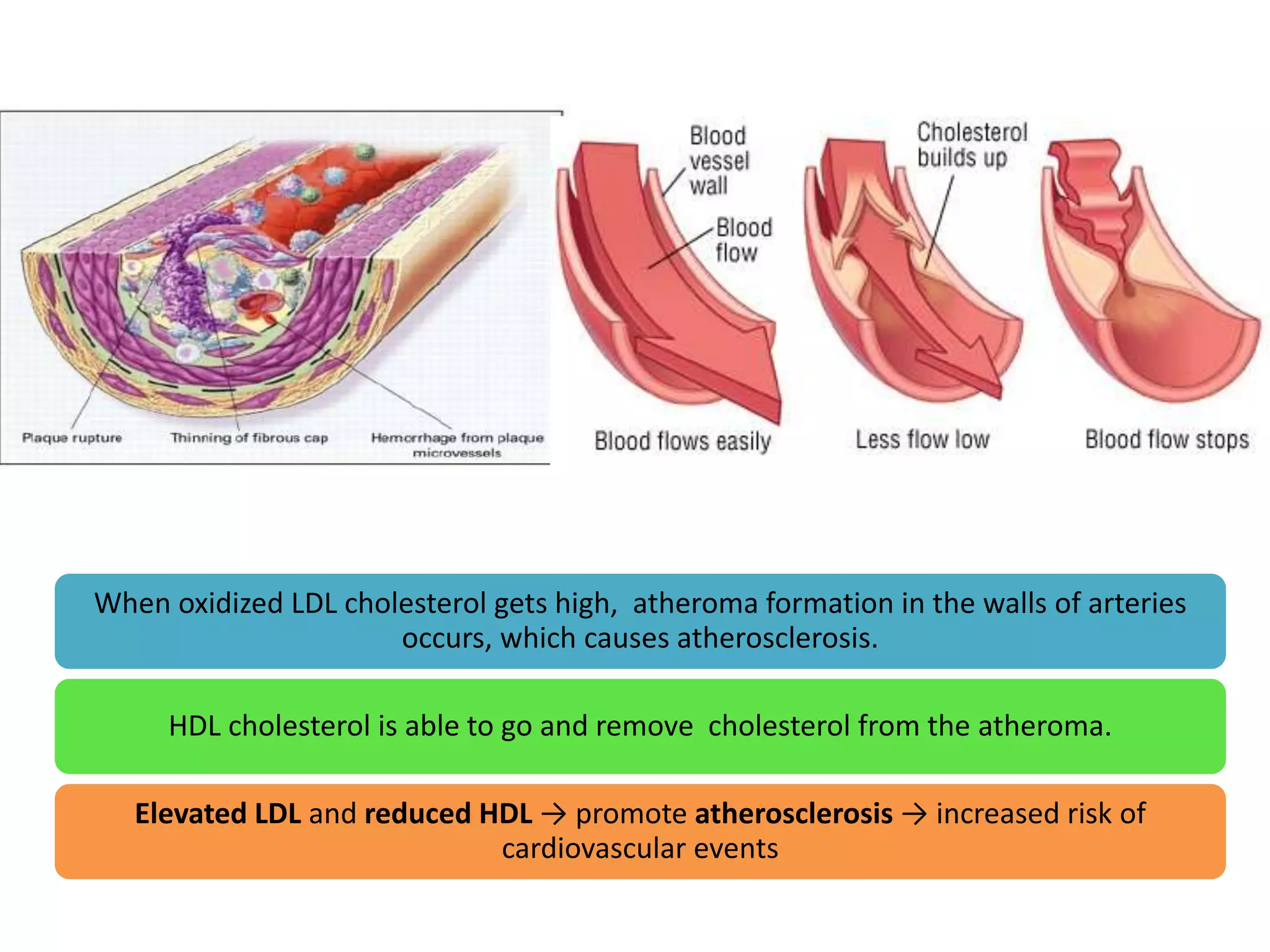 Hyperlipidemia | PPTX