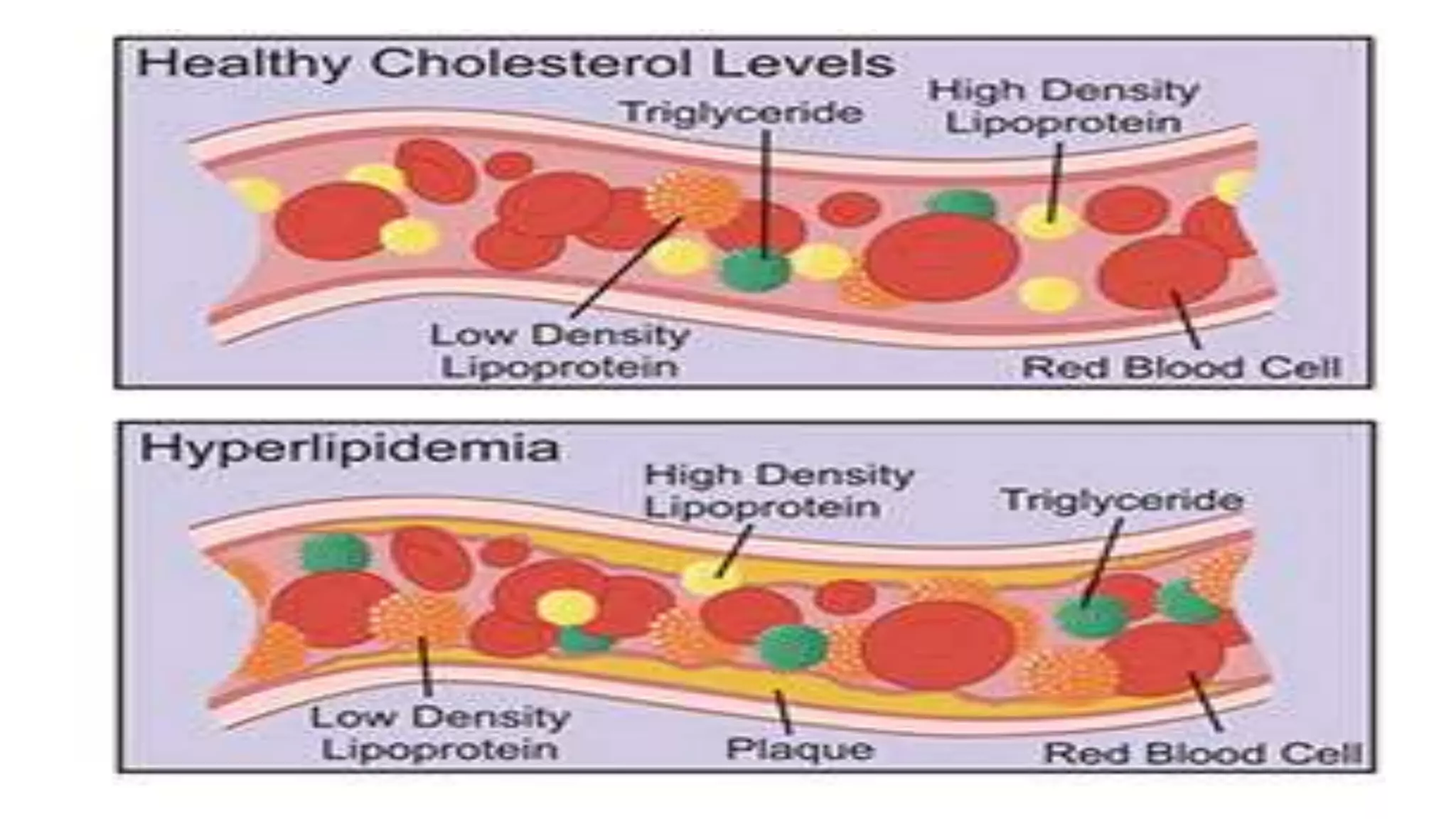HYPERLIPIDEMIA | PPTX