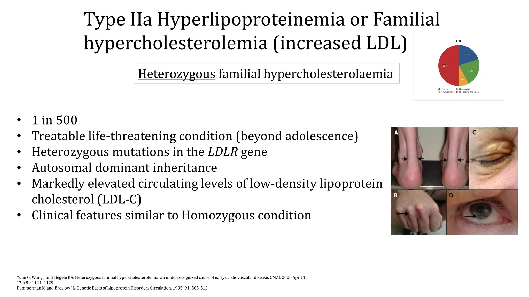 Hyperlipidemia - etiology epidemiology clinical features | PPTX