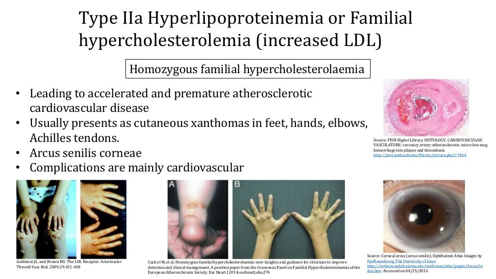 Hyperlipidemia - etiology epidemiology clinical features