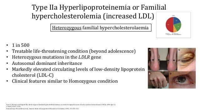 Hyperlipidemia - etiology epidemiology clinical features