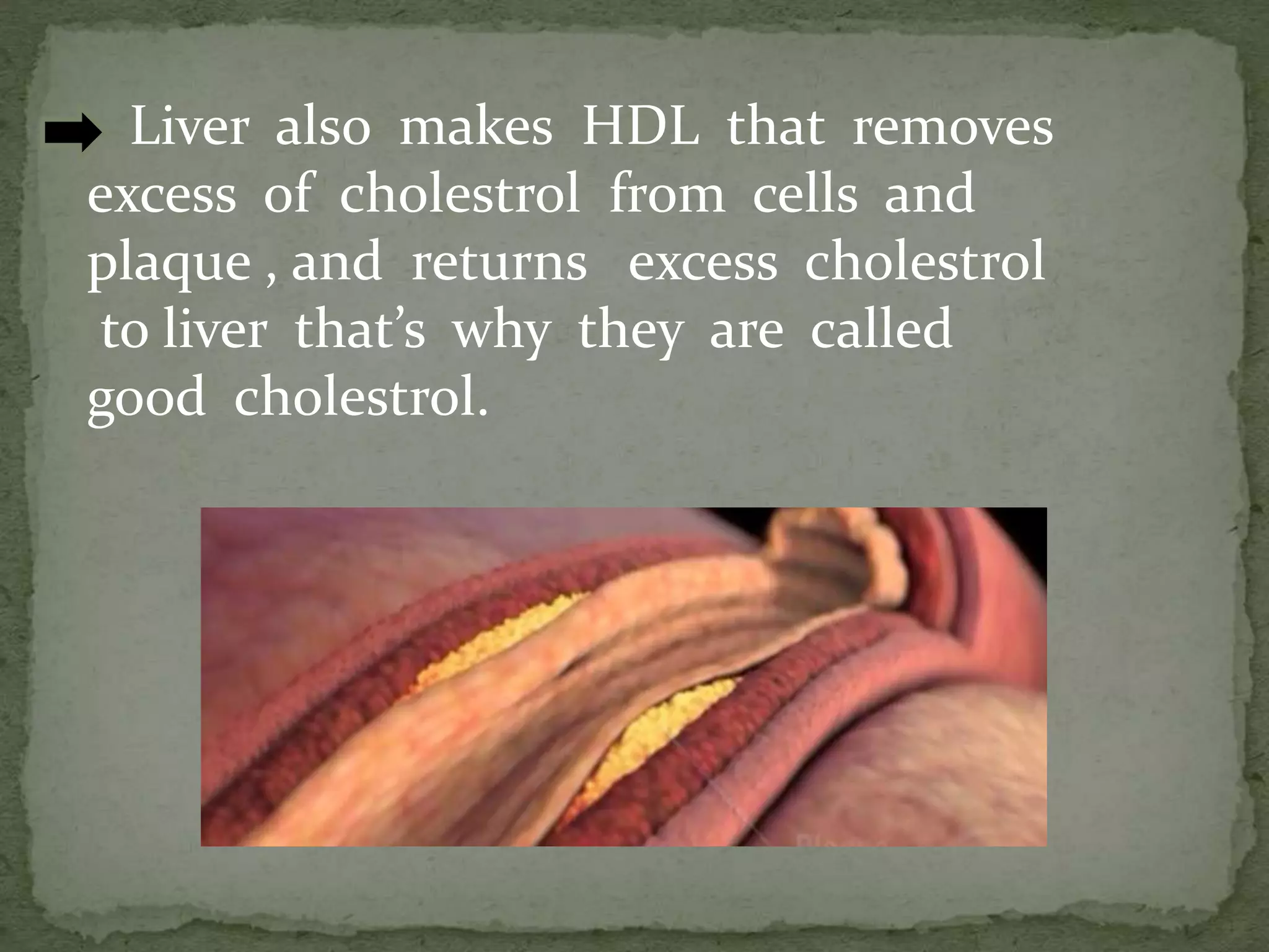 Hyperlipidemia, pharmacology | PPTX