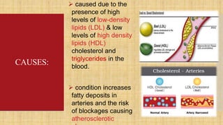 Hyperlipidemia, its causes, symptoms, medications, treatments, diet ...