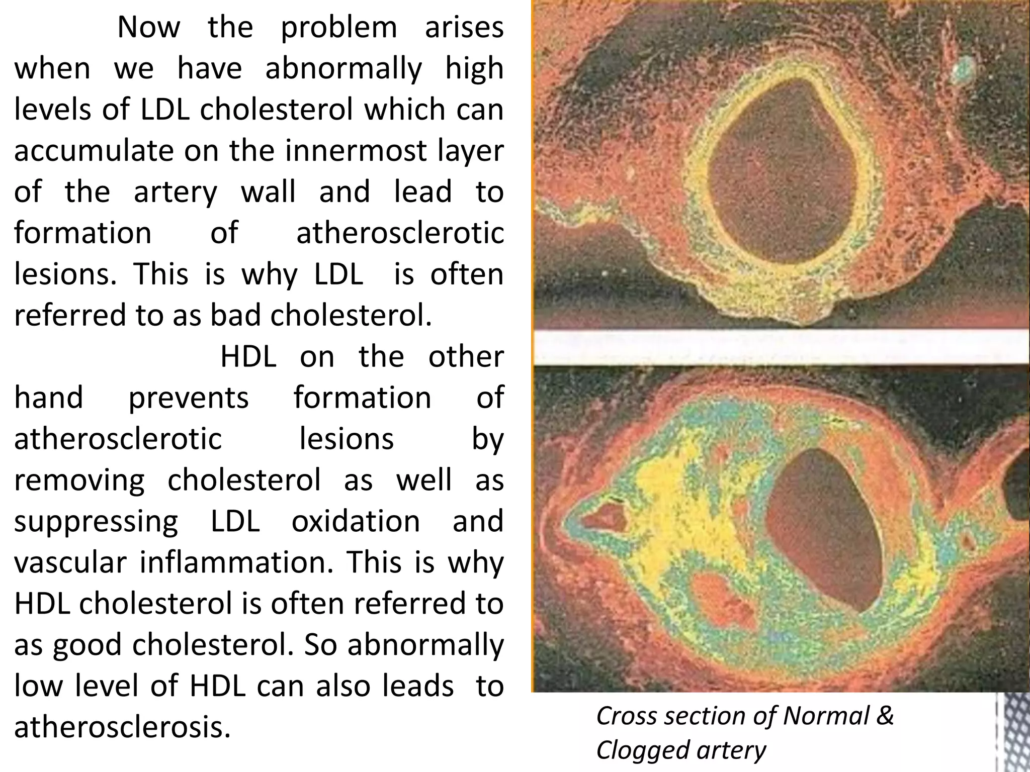 Hyperlipidemia | PPTX