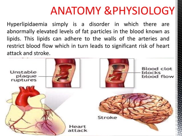 Hyperlipidemia | PPTX