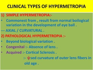 Hypermetropia | PPT