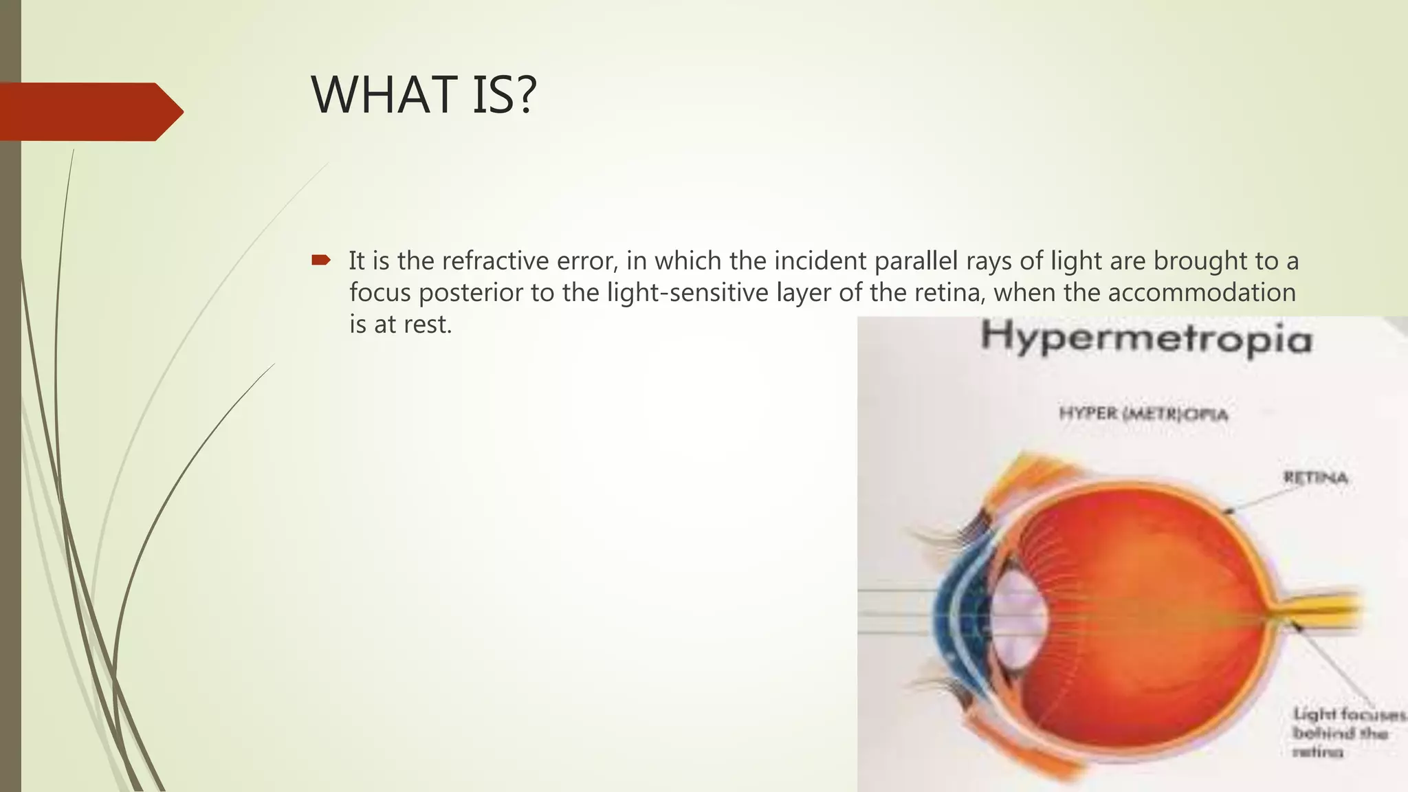 Hypermetropia | PPTX