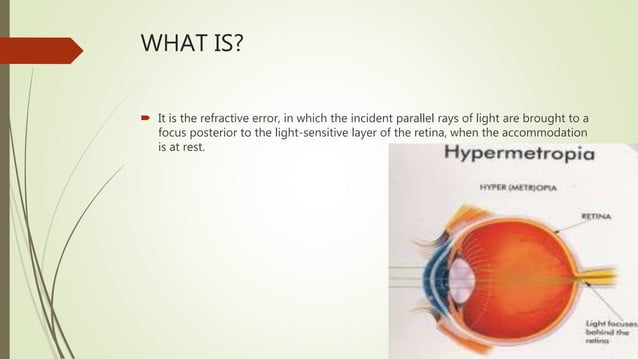 Hypermetropia | PPT
