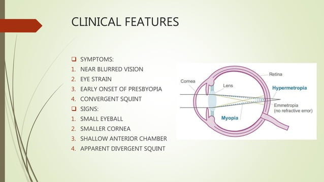 Hypermetropia | PPT
